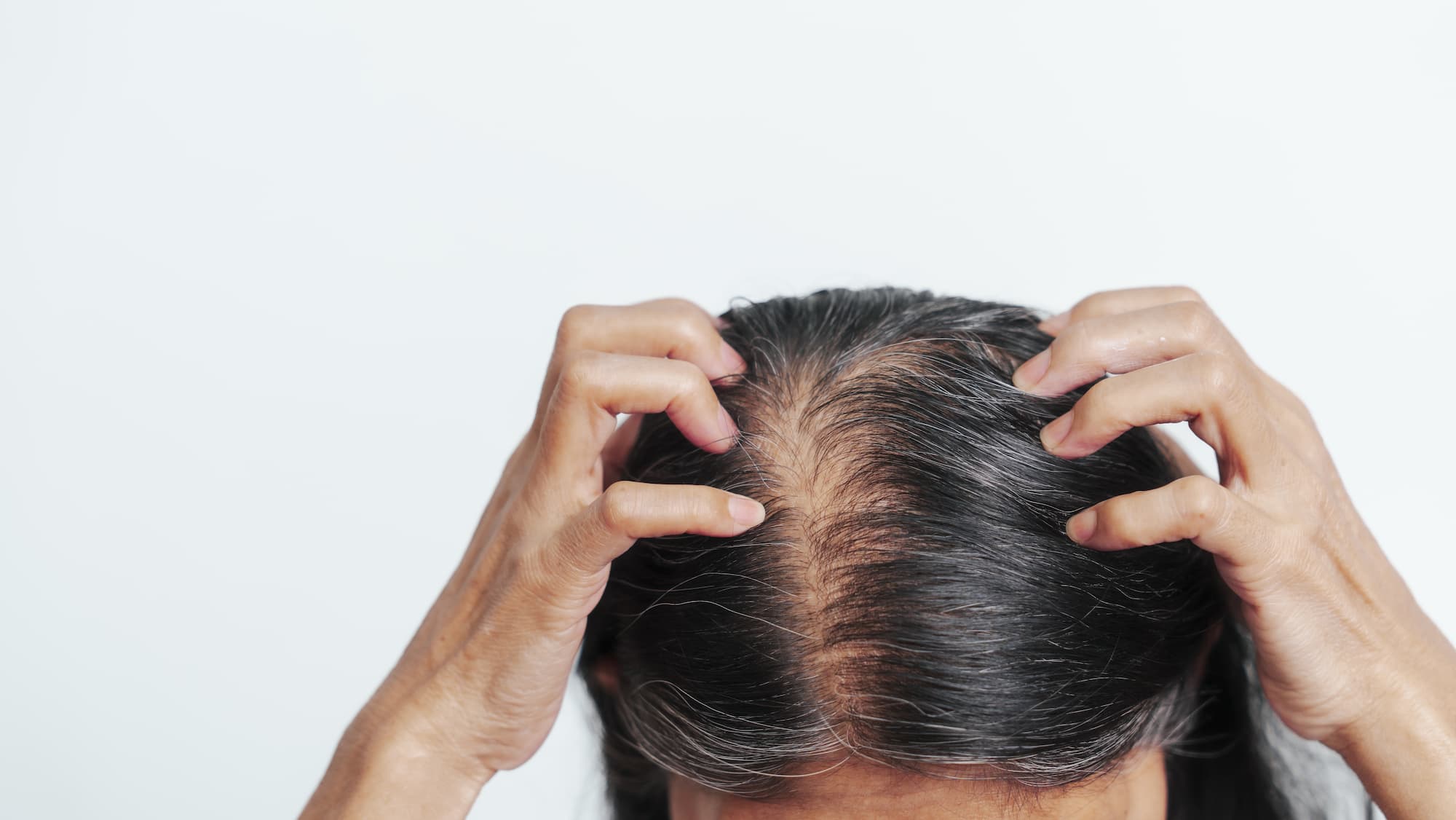 Expert Solutions for Menopause and Perimenopause Hair Loss | TM Hair in ...
